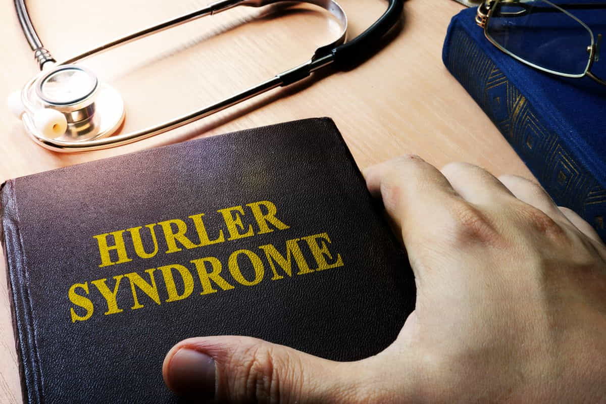 Hurler Syndrome- Treatments, Life Expectancy, Symptoms, & More